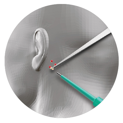 Dermomine Behandling Norge | Stamceller | Dr. Hazal Ferbu